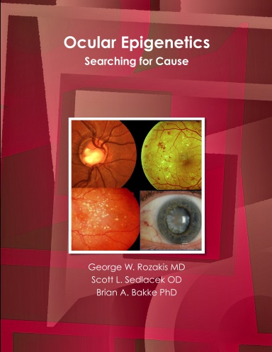 Epigenetics and Nutrigenomics for the Eye