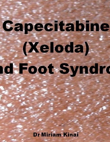 Capecitabine (Xeloda) Hand Foot Syndrome