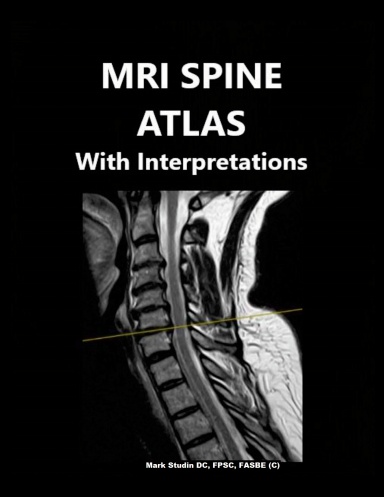 MRI SPINE ATLAS